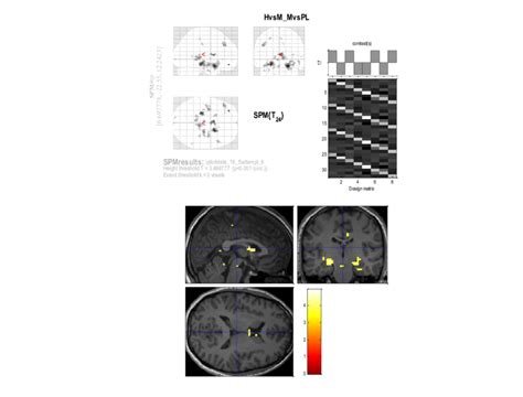 11 Fmri Results Double Interaction H Vs M X M Vs Pl The Brain Download Scientific Diagram