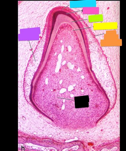 4 2 Dentin Lecture Pics Flashcards Quizlet