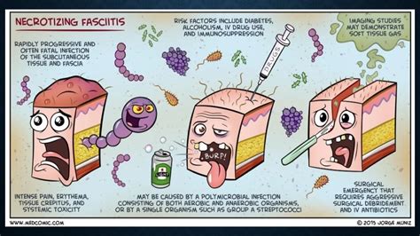 Necrotizing Soft Tissue Infection Vs Cellulitis Pptx Infectious
