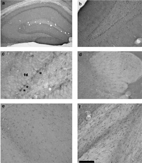 Mif Distribution In The Brain A Panoramic View Of The Hippocampus Download Scientific