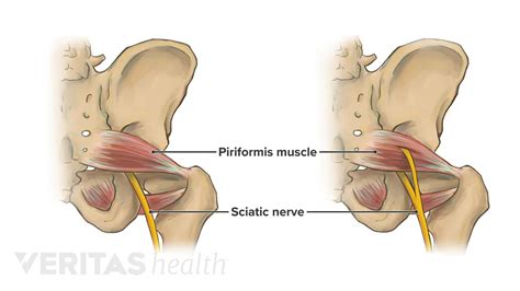 Sciatic Nerve