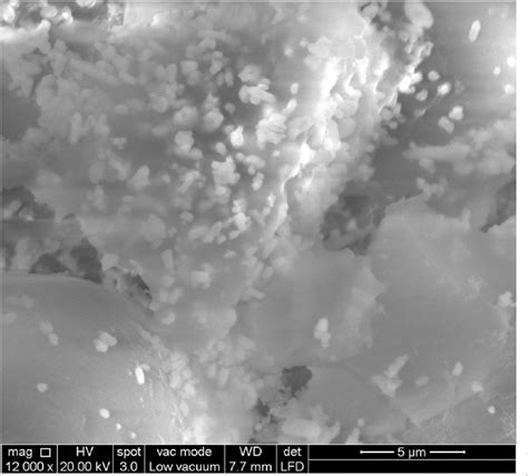 A Fragment Of The Antibiotic Spacer Was Examined On The Scanning