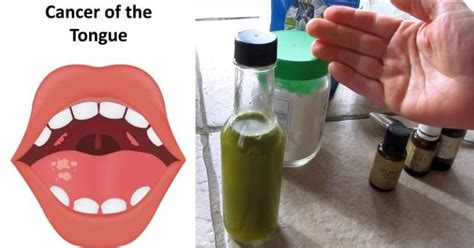 Your Mouthwash Is Full Of Cancer Causing Chemicals Use This Instead