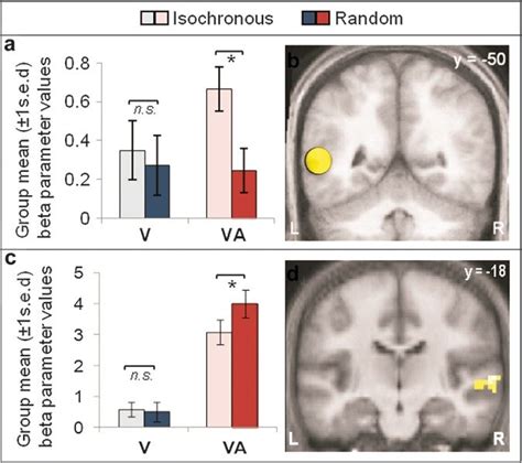 Auditory Tone Modulates Impact Of Visual Stimulus Timing On Psts Roi Download Scientific