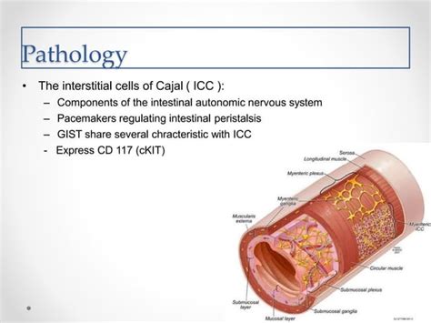 Gastrointestinal Stromal Tumour Gist D1 Ppt