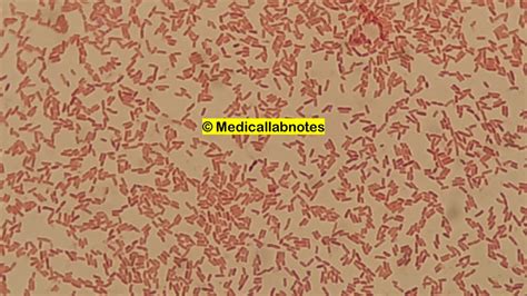 Burkholderia Cepacia Burkholderia Cepacia Selective Agar Pkoj