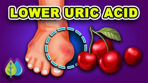 Ways To Lower Uric Acid Naturally