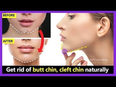 Cleft Chin Artofit