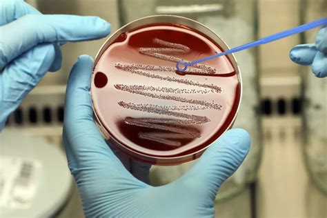 What Is Streptococcal Toxic Shock Syndrome And Why Is Japan Worried