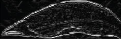 The Edge Detection Result Of The Image By The Sobel Operator Download Scientific Diagram