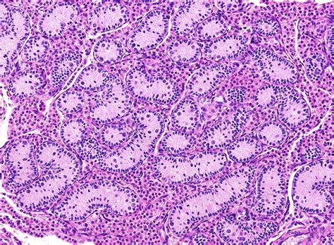 Fetal Testis Light Micrograph Stock Image C0264025 Science