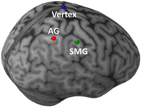 Sites Of TMS Stimulation Shown On The Brain Of A Single Illustrative Download Scientific