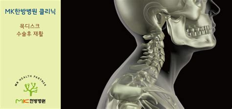 게시판 공지사항 목디스크 수술후재활 운동치료 재활클리닉 한방재활의학과 광주도수치료 척추통증 만성통증 통증클리닉 엠케이한방병원 허리디스크 무릎통증 Mk한방병원