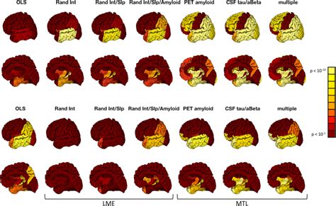 Top Significance Of Cross‐sectional Diagnostic Group Differences In
