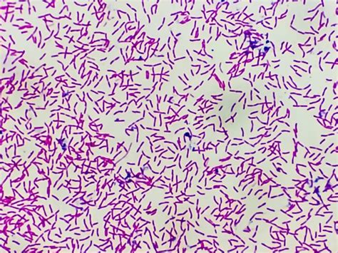 Gram Stain Microscopic Morphology
