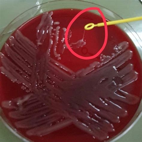Positive String Test On A Klebsiella Pneumoniae Hypervirulent Strain