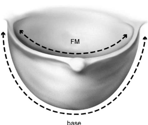 The Relationship Between The Base And Free Margin Lengths Base ≈ 15