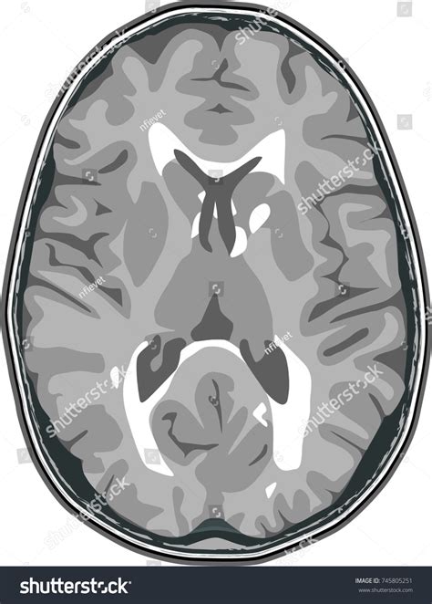 뇌 Mri 3363개가 넘는 로열티 프리 라이선스 대상 스톡 벡터 및 벡터 아트 Shutterstock