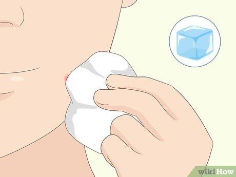 Ways To Hide Pimples WikiHow