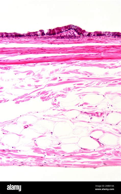 Human Gallbladder Wall Section Showing From Up To Down Simple Columnar