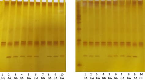 Results Of Enzymatic Digestion Of Rs2253206 Pcr Products Download Scientific Diagram