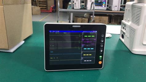 Rsd6000 Mini Size Multi Parameters Patient Monitor Vital Signs Monitor