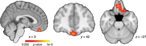 A Whole Brain Voxel Wise Linear Mixed Effects Regression Restricted To Download Scientific