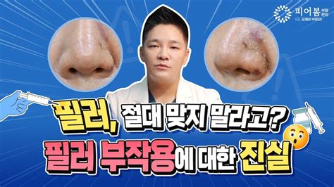 필러 부작용 괴사 절대 맞지 말라고요 쁘띠닥터가 설명해 드립니다🩺 Youtube