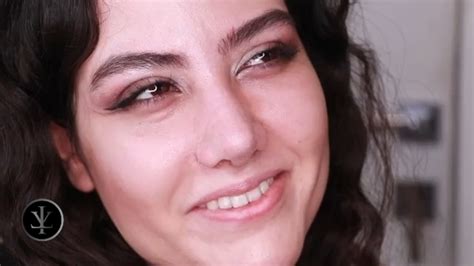 نتیجه جراحی بینی پس از یک ماه دکتر رویا لطفی یگانه نماشا