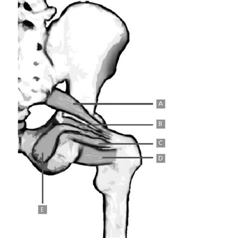 Classification Of Hip Dislocation Thompson And Epstein Download Table