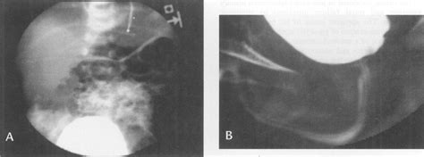 Voiding Cystourethrogram Examination Performed After The Cessation Of Download Scientific