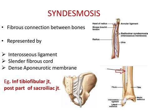 Joints Anatomy Anatomy Of Joint Pptx Pptx