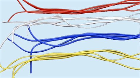 Vascular Doppler Medlex Medical Systems Medlex Square Kochulloor