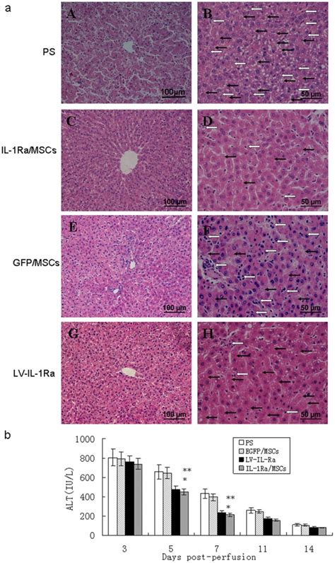 Increased Infiltration Of Mononuclear Cellswhite Arrow Vacuolar