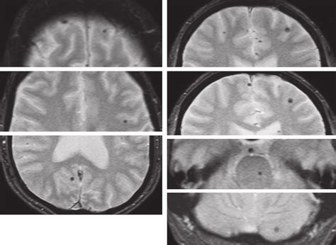 Brain Mri T 2 Magnetic Resonance Imaging 15 T Axis T 2 Download Scientific Diagram