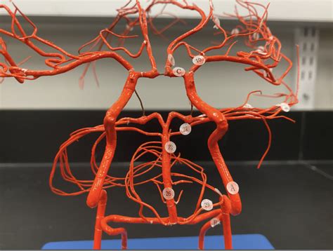 Diagram Of Circle Of Willis Model Quizlet