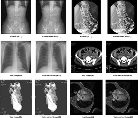 Dataset For Second Evaluation Contains 20 Selected Grayscale DICOM