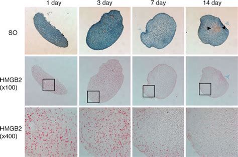 Hmgb2 Expression During Chondrogenesis Of Human Msc Download Scientific Diagram