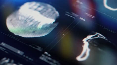 1393 Human Jaw And Teeth Stock Videos Footage And 4k Video Clips