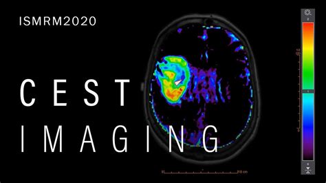 Cest Imaging Analyticsweek All Things Analytics Leadership News