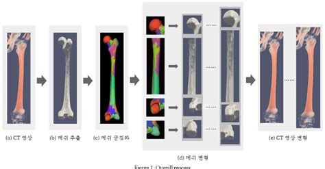 Figure 1 From Data Augmentation Method For Deep Learning Based Medical Image Segmentation Model