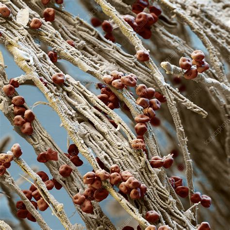 Rust Fungus Sem Stock Image B250 1773 Science Photo Library
