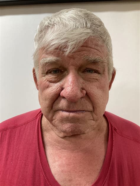 Benjamin Sharp Violent Or Sex Offender In Aurora In 47001 In2226381