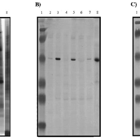 Western Blot Immunoblot Analysis Of Total Protein Extracts From