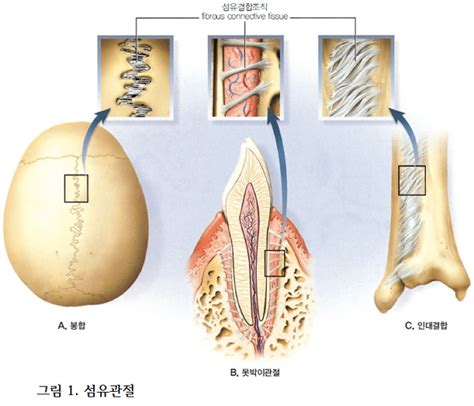 손가락 당기면 “똑” 소리가 나는 이유는