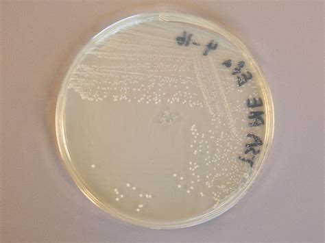 Enterococcus Faecalis Classroom Bacterial Identification Wiki Fandom