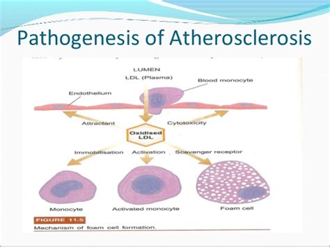 Pathophysiology Of Atherosclerosis