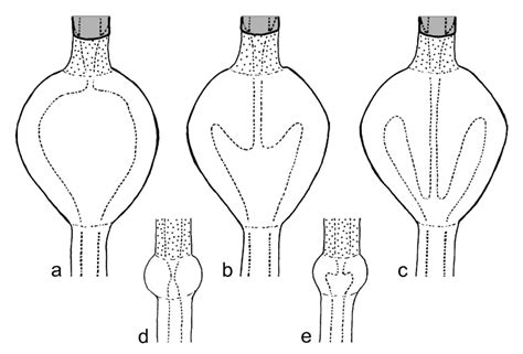 Detail Of The Ampulla Showing Different Degree Of Development Of The Download Scientific