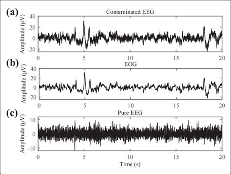 the separation of clean eeg from the contaminated data using dwt