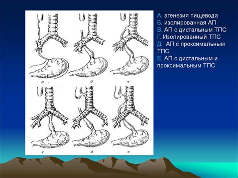 Неотложная хирургия норожденных - online presentation